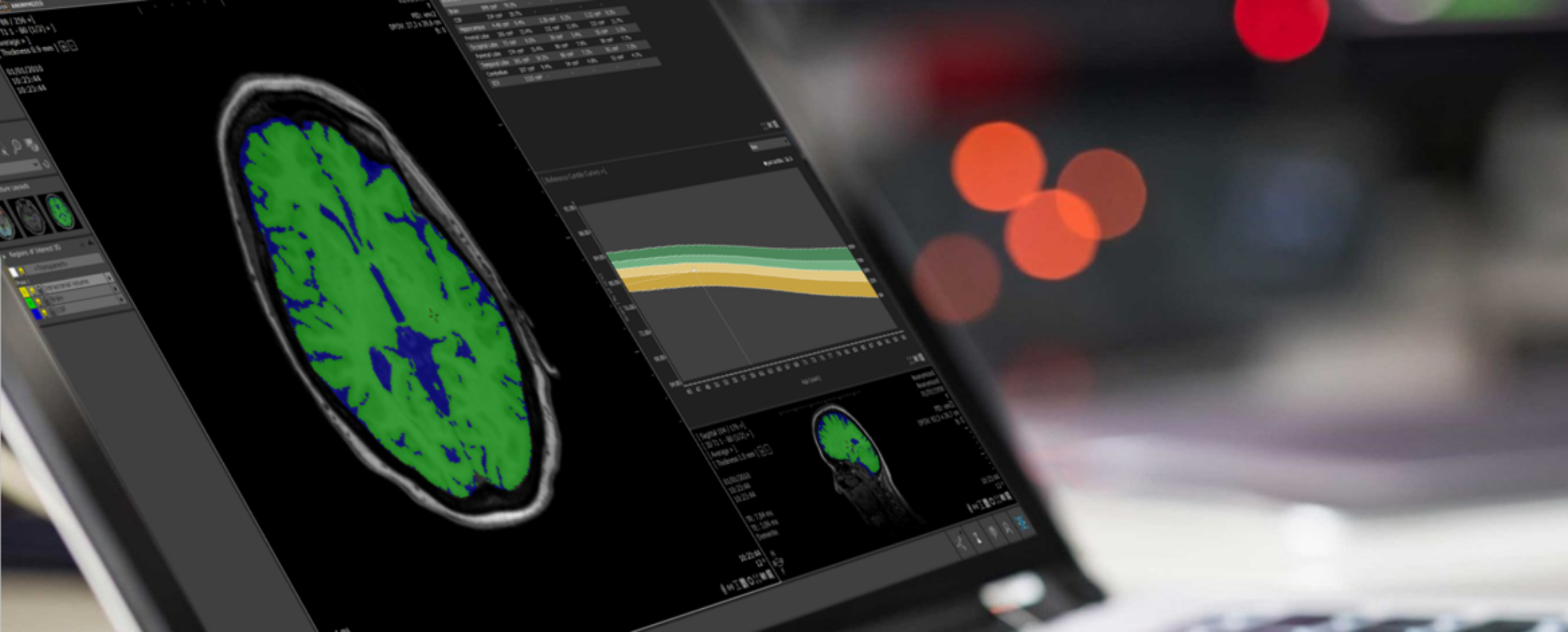 About us | Get to know Quantib BV