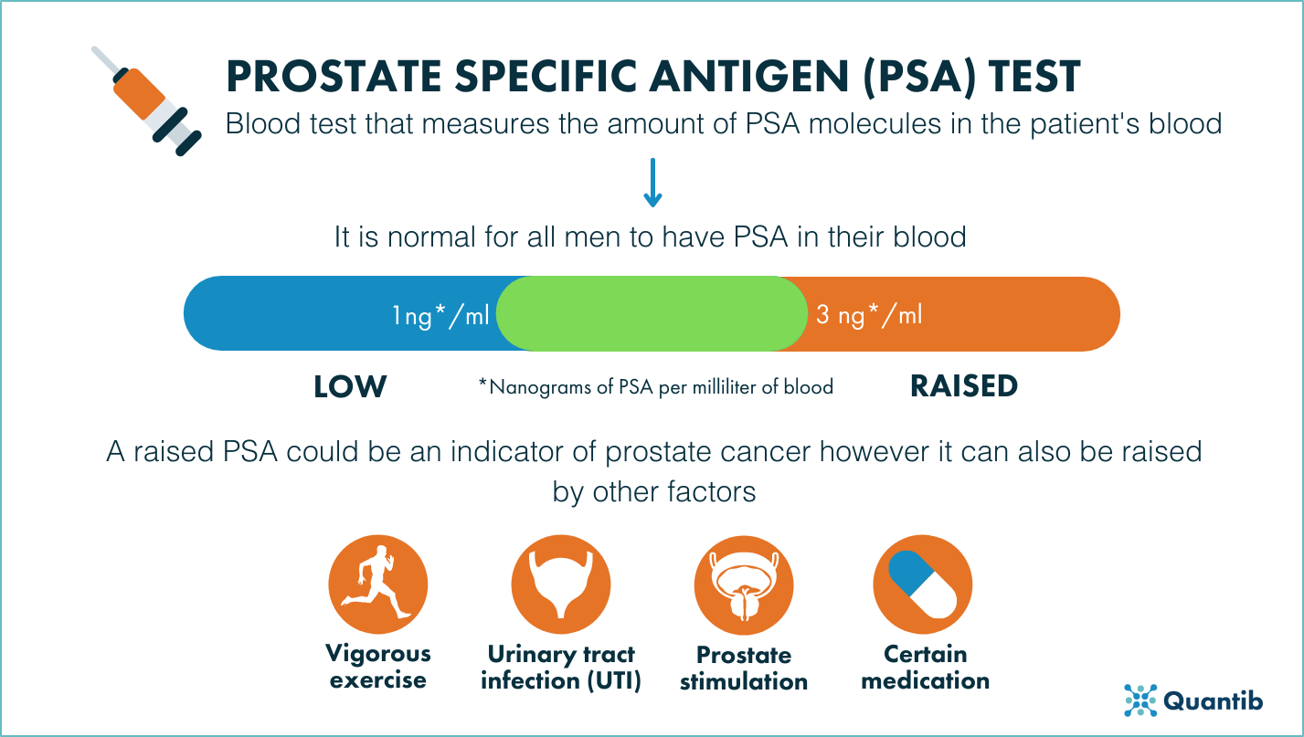 How can urologists improve patient care in the prostate cancer pathway?