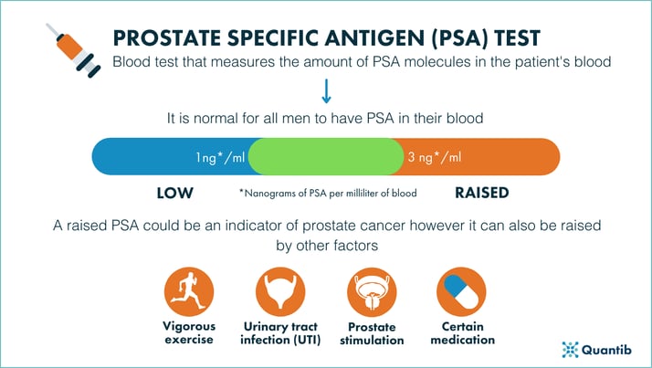How can urologists improve patient care in the prostate cancer pathway?