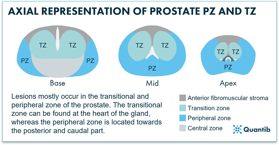 The basics of PI-RADS scoring and how AI can help