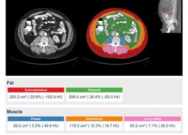 Quantib Body Composition | Research Software