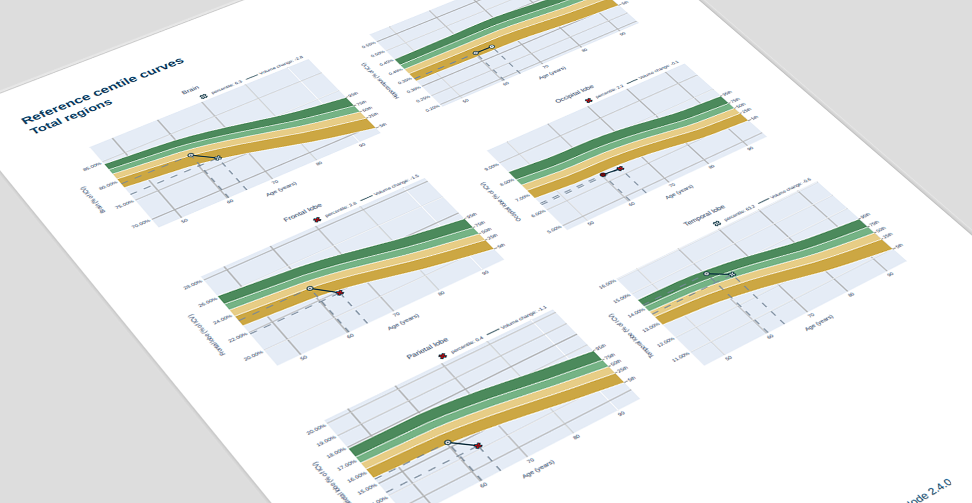 Brain Segmentation Software - Quantib Neurodegenerative (ND)