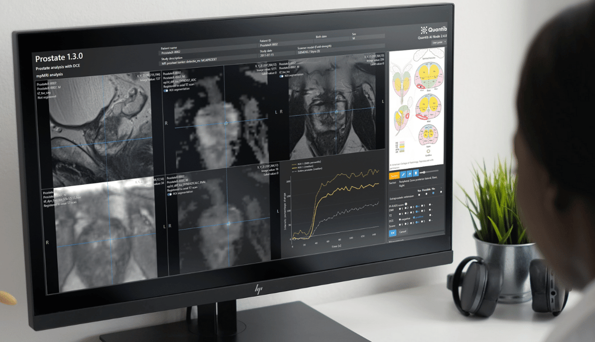 Prostate MRI Reading Software | Quantib® Prostate