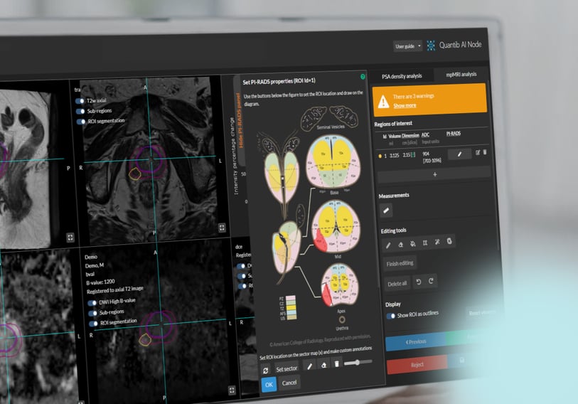 Prostate MRI Reading Software | Quantib® Prostate