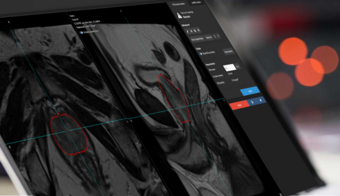 Prostate MRI Reading Software | Quantib® Prostate
