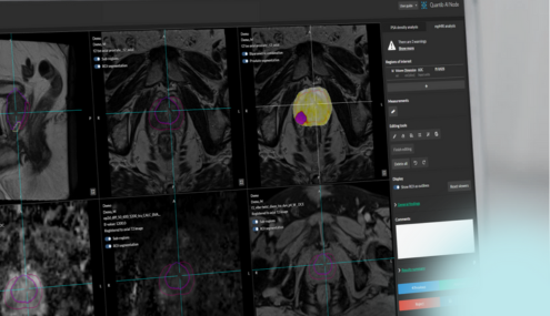 Prostate MRI Reading Software | Quantib® Prostate