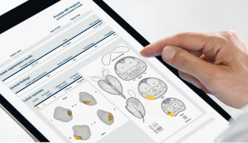 Prostate MRI Reading Software | Quantib® Prostate