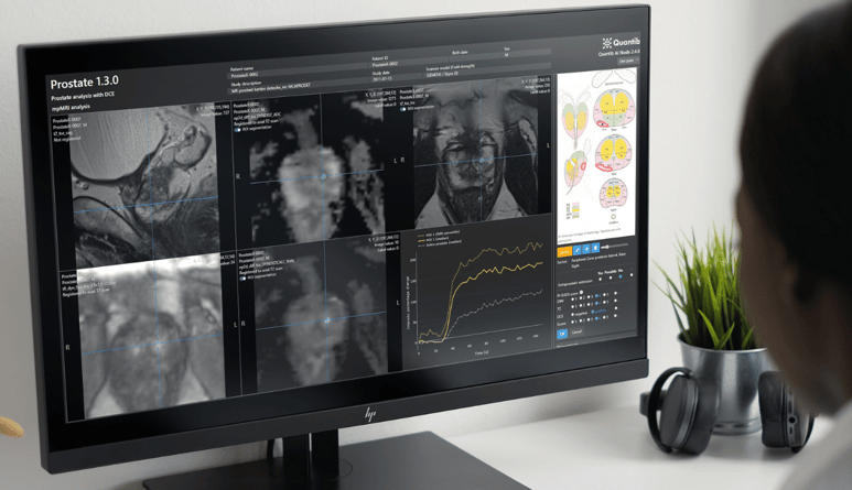 Quantib launches the upgrade of their AI prostate solution: Quantib ...