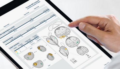 Prostate MRI Reading Software | Quantib® Prostate