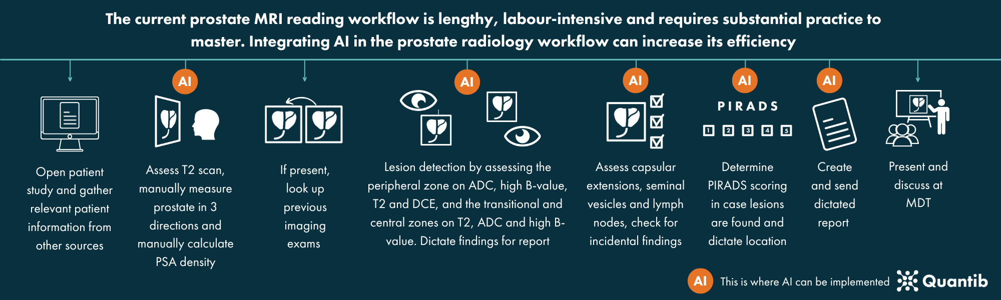 Prostate MRI Reading Software | Quantib® Prostate