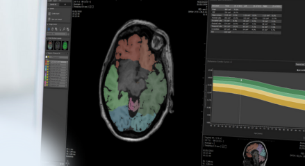 Brain Segmentation Software - Quantib Neurodegenerative (Quantib® ND)
