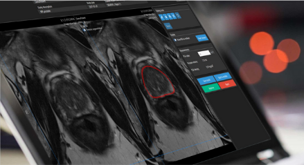 Prostate MRI Reading Software | Quantib® Prostate