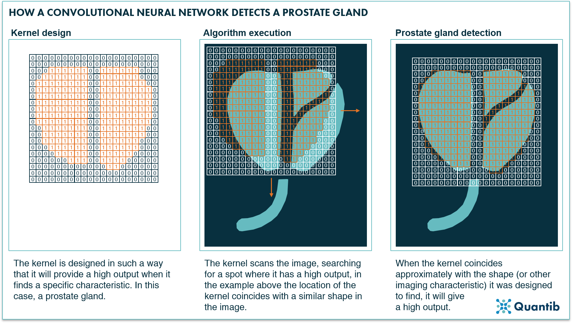 Deep learning radiology: the secret of convolutional neural networks