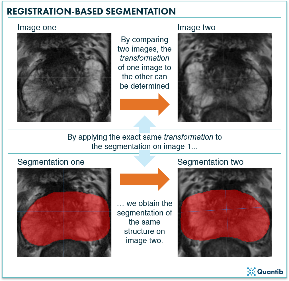 Deep learning applications in radiology: image segmentation