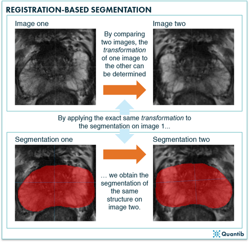 Deep learning applications in radiology: image segmentation