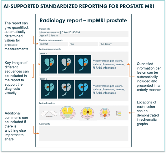 6 ways AI can support prostate MRI reporting