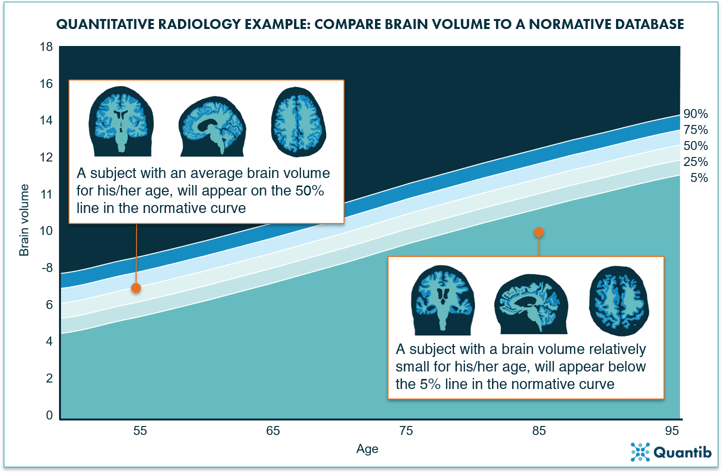 Quantitative Radiology is Finally Coming