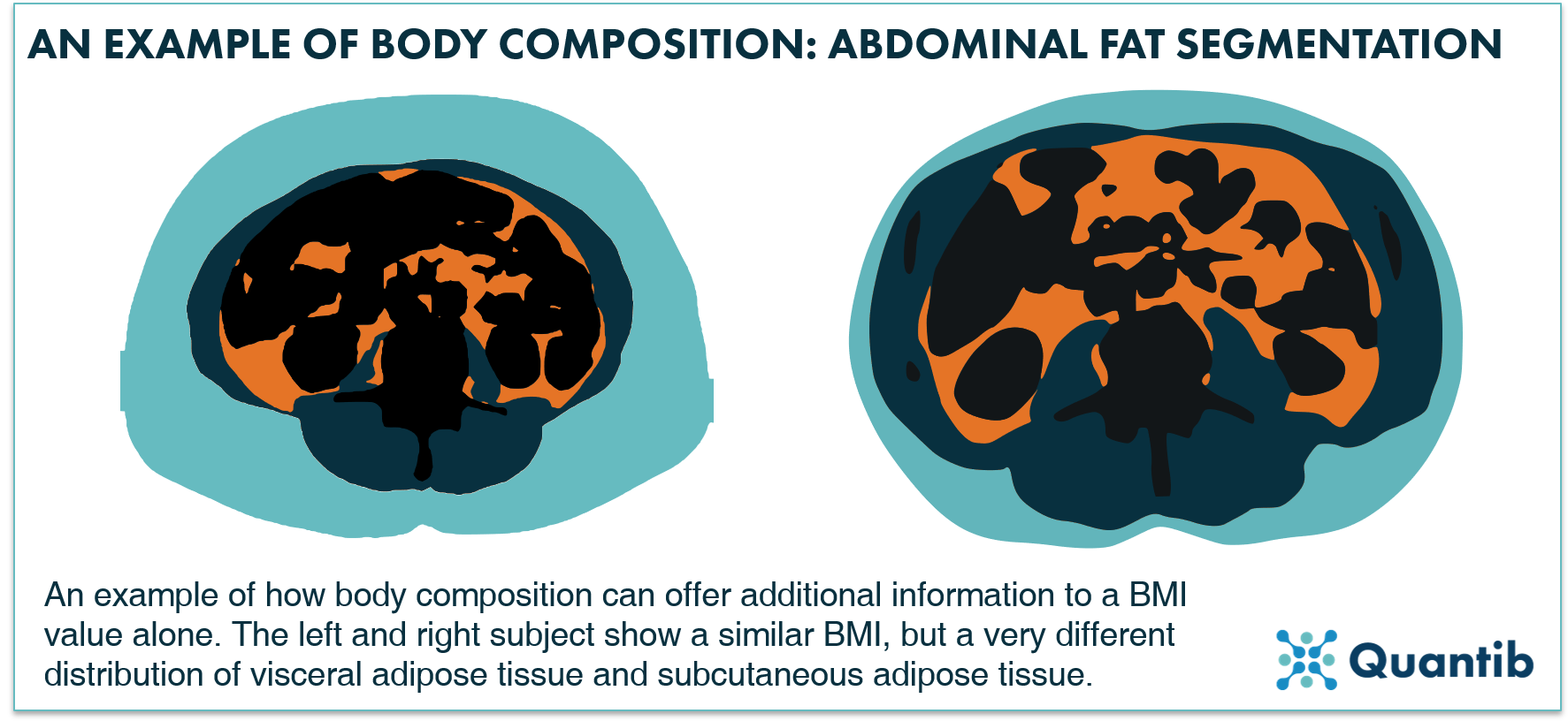 6 use cases for CT body composition with AI