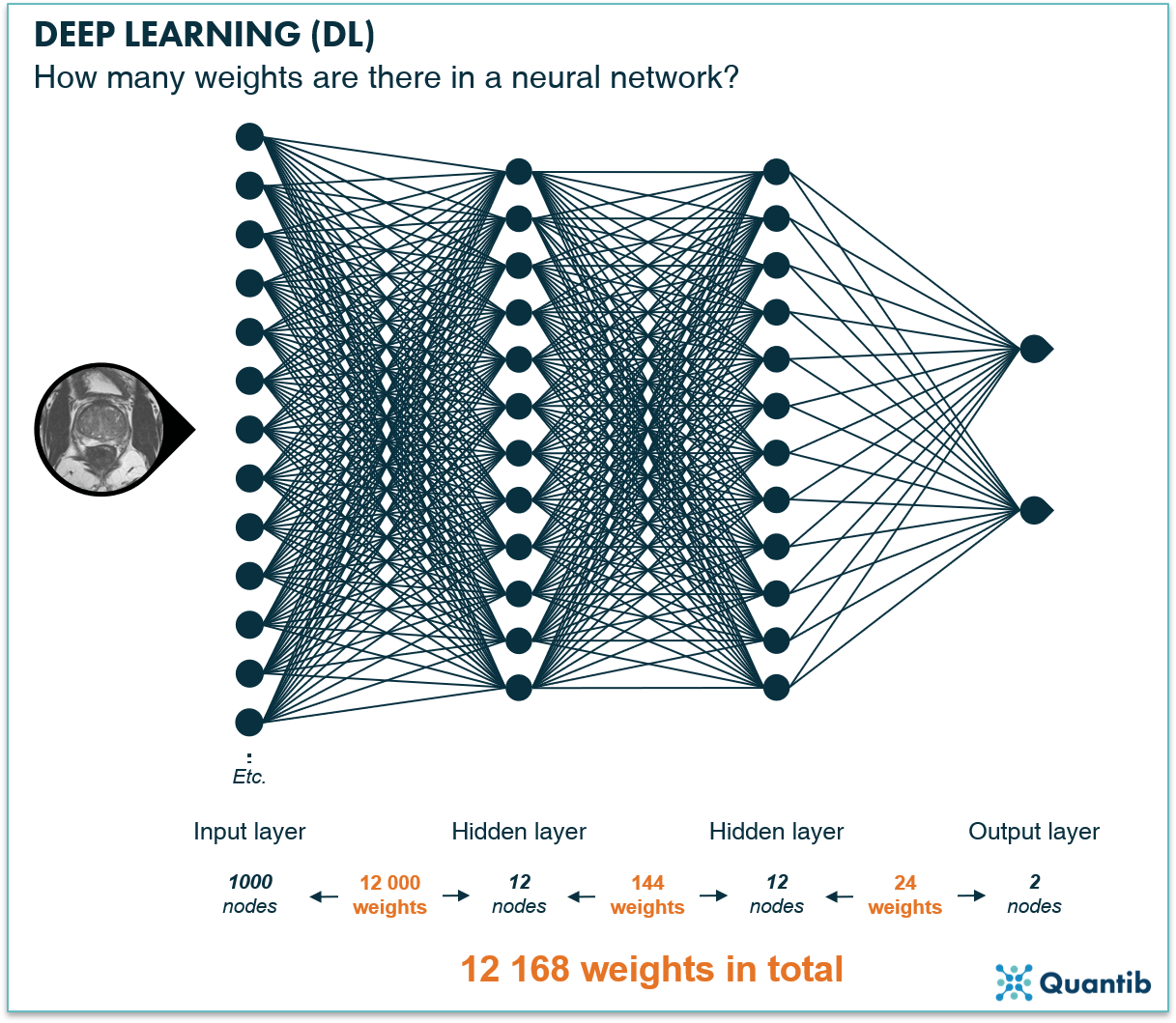 How does deep learning in radiology work?