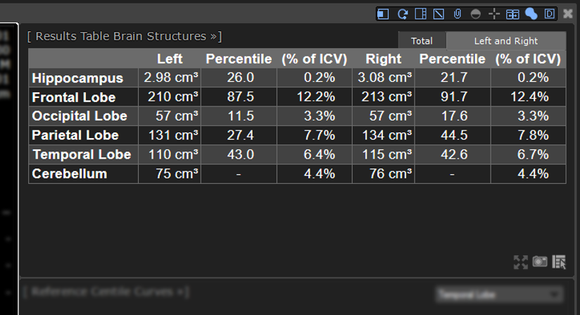 Brain Segmentation Software - Quantib Neurodegenerative (Quantib® ND)