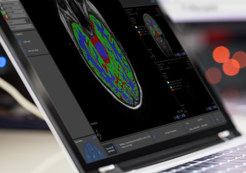 About Quantib BV | Radiology Software Technology Developer