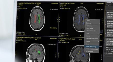 Radiology Software | Quantitative Imaging Biomarkers | Quantib BV