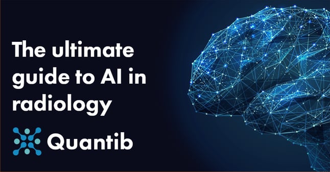 Medical Image Analysis Software Development | Quantib BV