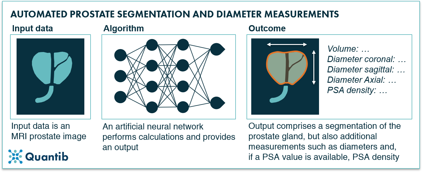The ultimate guide to AI in prostate cancer