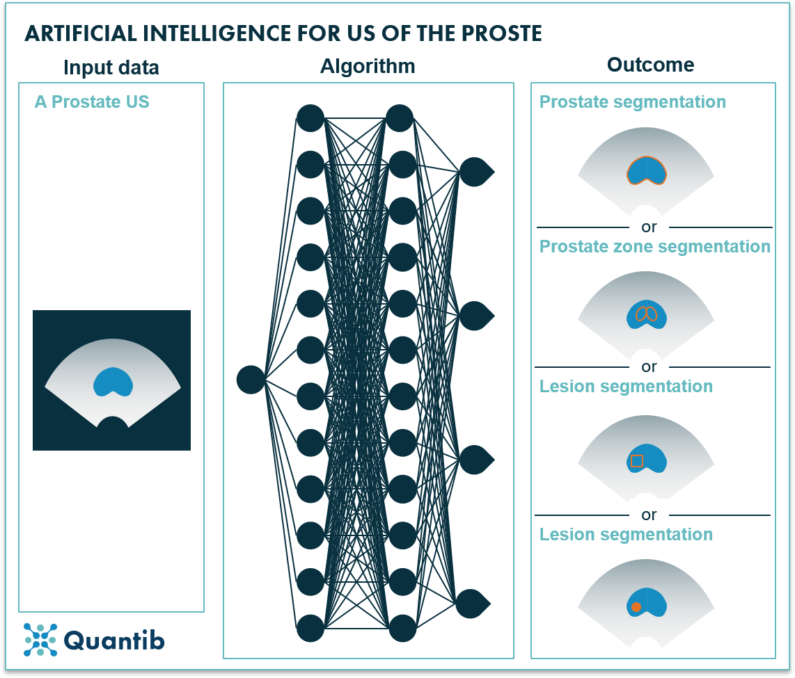 The ultimate guide to AI in prostate cancer