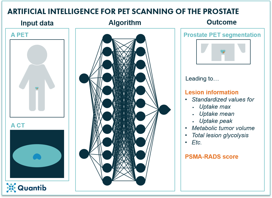 The ultimate guide to AI in prostate cancer