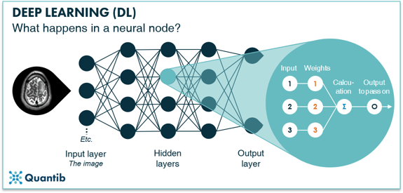 How does deep learning in radiology work?