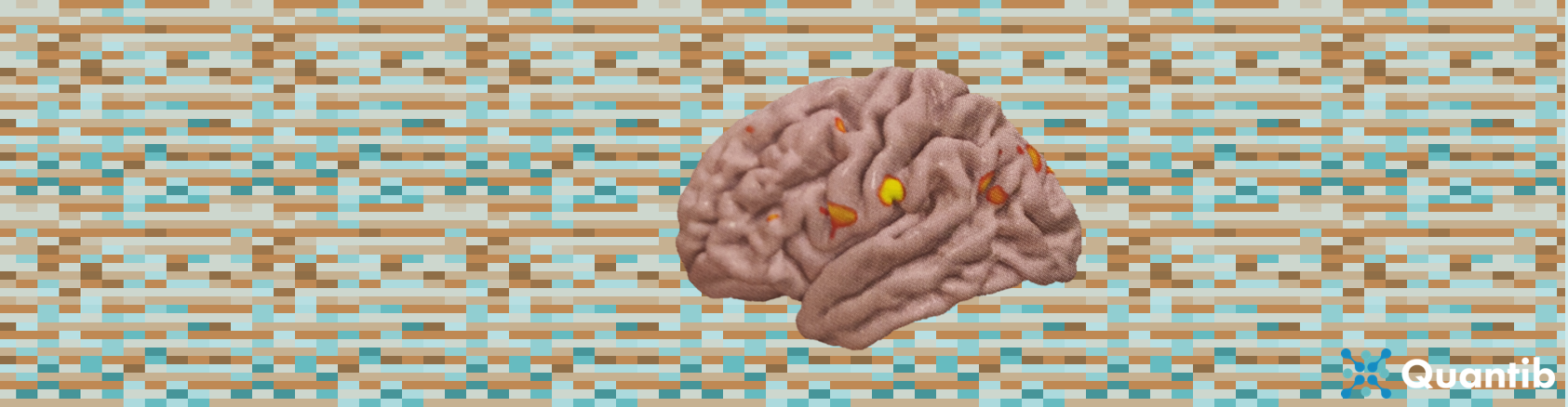 Linking MRI brain images to genetic profiles at voxel level: an imaging ...