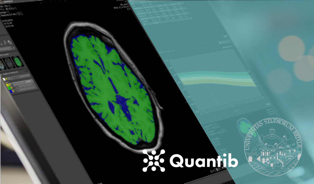 The University of Brescia announces the installation of Quantib® ND Plus