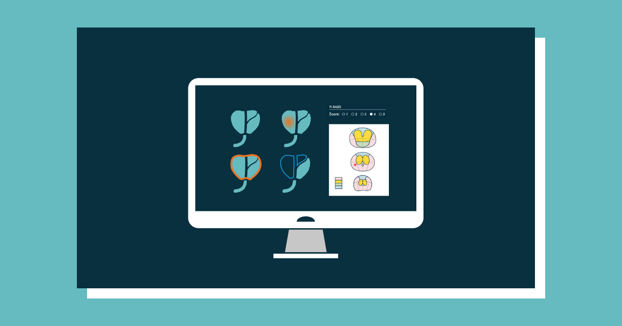 Dr. Steiner’s real-world validation study of Quantib® Prostate