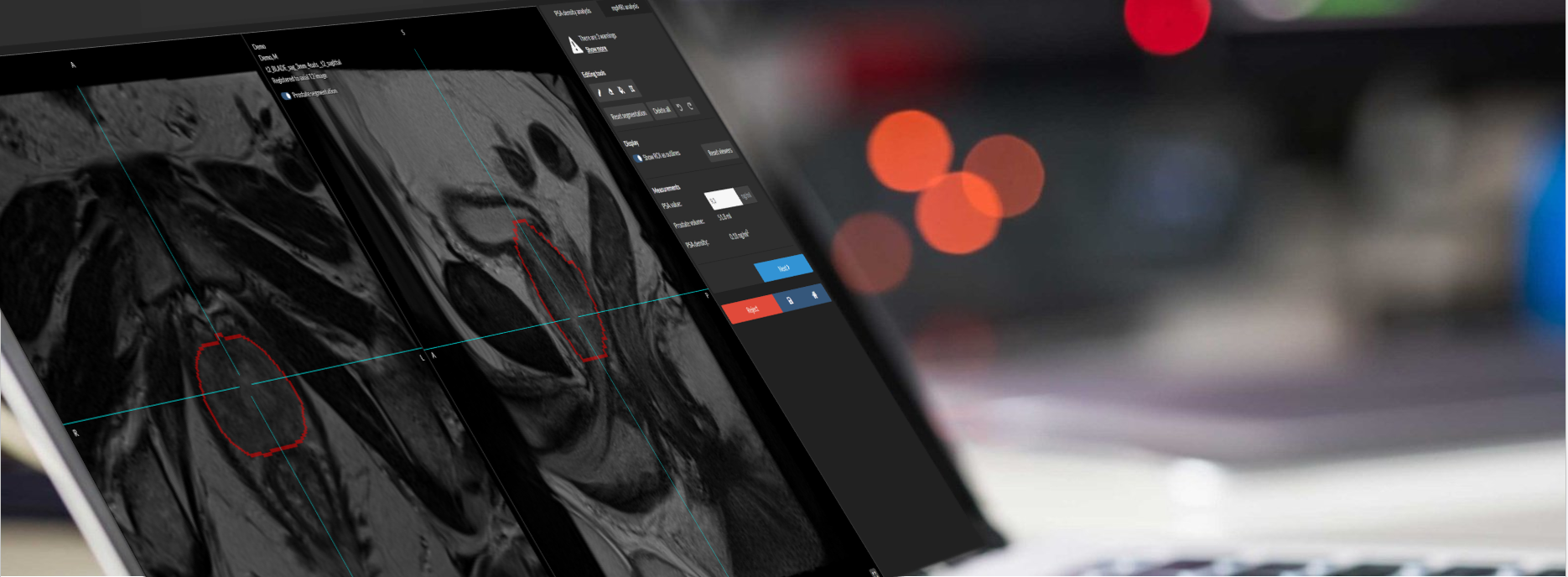 RadNet’s Quantib B.V. Subsidiary Receives FDA Clearance for its Quantib ...