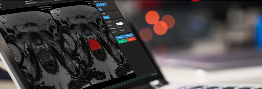 Prostate MRI Reading Software | Quantib® Prostate